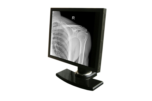 Advantages of the image intensifier system - Professional Manufacturer ...